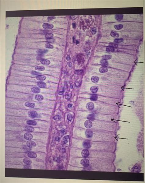 Solved A Simple Squamous B Simple Columnar C Connective
