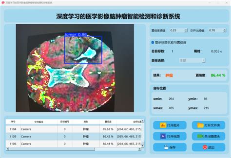 基于yolov8深度学习的脑肿瘤智能检测系统设计与实现 pyqt5界面 数据集 训练代码 中猿创新 7zcode