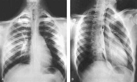 Thoracic Viscera Radiology Key