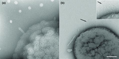 Transmission Electron Micrographs Of Whole Mount Negatively Stained