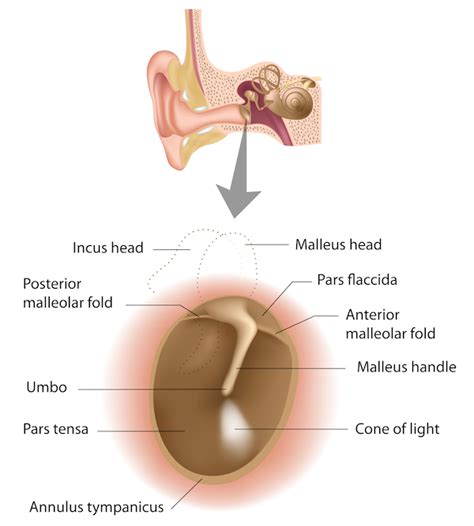 Perforated Eardrum Rch At Maria Vitagliano Blog