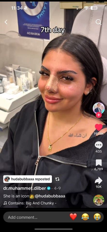 Love Island Usa Star Huda Mustafa Admits Botched Plastic Surgery Secret