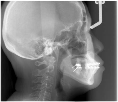 Bioengineering An Open Access Journal From Mdpi