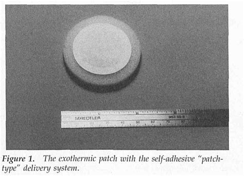 Heat Warts Away 111℉ Hyperthermia