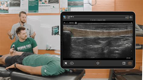 Msk Ai For Patellar Tendon Assessment Clarius