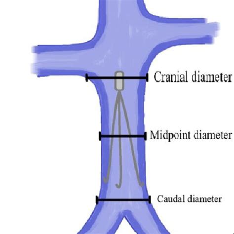 Diagram Illustrating The Points Of Measurement Of The Diameters Of The