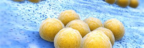 Immune And Clinical Signatures Predicting Persistent Mrsa Bacteremia