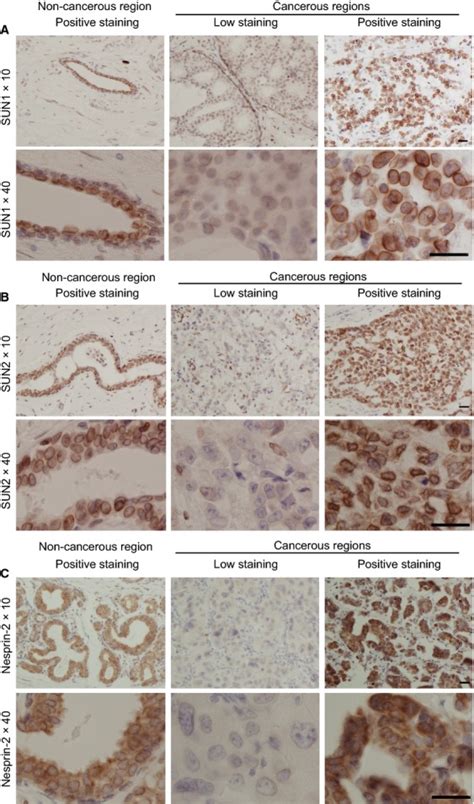 Global Loss Of A Nuclear Lamina Component Lamin A C And Linc Complex
