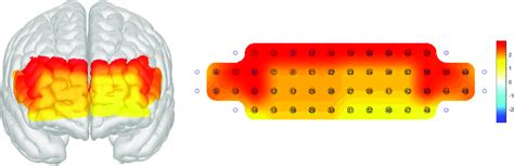 Fnirs Group Effect Map F Values Showing Differential Group Activation