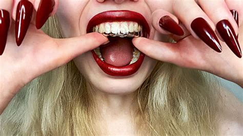 Shye White Orthodontic Cap And Spitting Manyvids