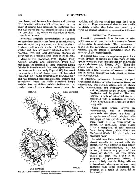 A Study Of The Pathology And Pathogenesis Of Bronchiectasis Pmc