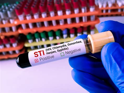 Why Std Testing Is Essential Prevent Spreading