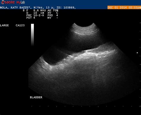 Bladder Mass Members