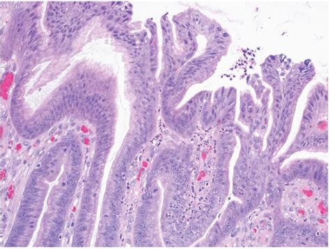 Stomach Abdominal Key