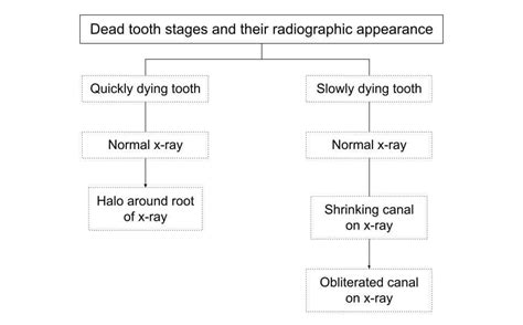 What Dead Teeth Look Like On X Rays 1311 Jackson Ave Dental Dentist
