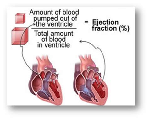Exam 1 Flashcards Quizlet