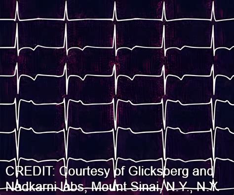 End Of Electrocardiogram Cables How One Patch Is Redefining Cardiac Diagnostics