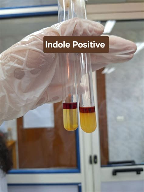 Aya Zahran1 On Linkedin Fig The Indole Test A Positive Indole Test