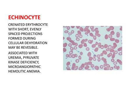 Ppt Hematology Powerpoint Presentation Free Download Id 2241331