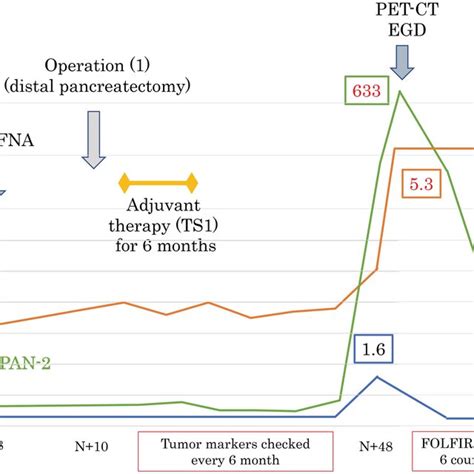 Mrcp Findings And Ct Findings A Mrcp Showed Stenosis Of The Mpd Download Scientific Diagram