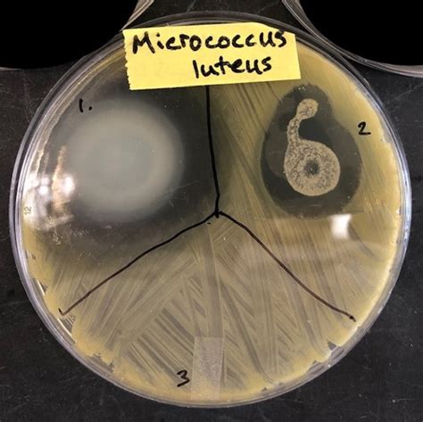 Microbiology Lab Practical Lysozyme Lab Flashcards Quizlet