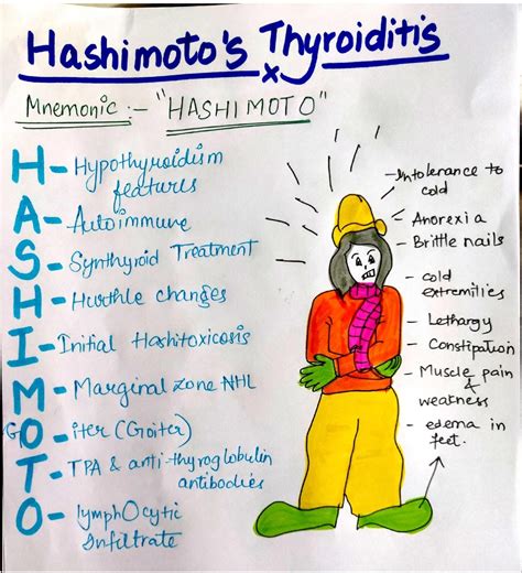 Hashimotos Thyroiditis Mnemonic Symptoms Treatment And More