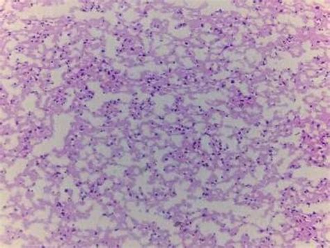 Novus Biologicals Brain Temporal Lobe Tissue Slides Alzheimers