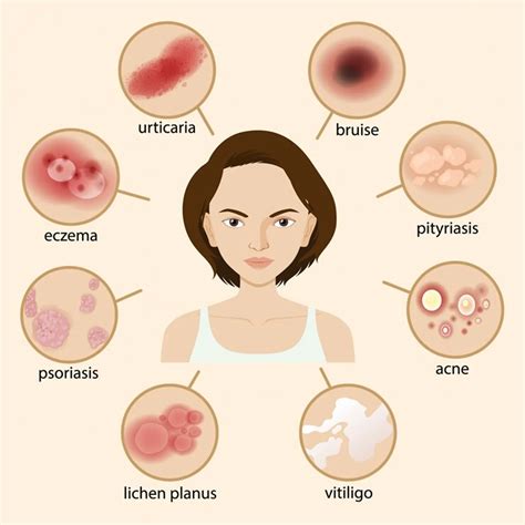 5 Most Common Skin Rashes And How To Deal With Them Life Style News