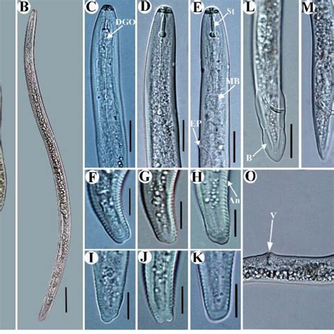 Photomicrographs Of Pratylenchus Coffeae In Plantain A Female B