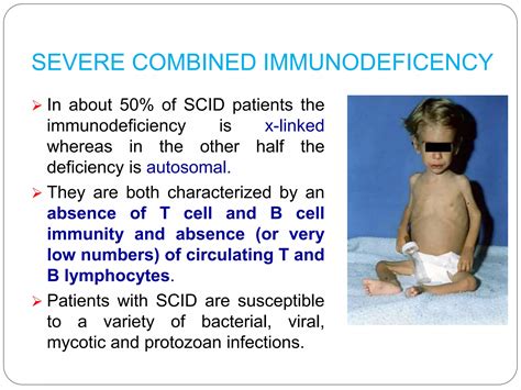 Immunodeficiency Pptx