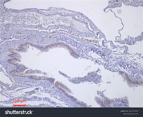 Immunohistochemistry Staining Used Histopathology Do Research Stock