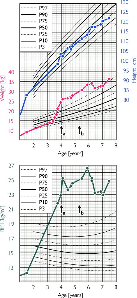 Weight Height And Body Mass Index Bmi Curve Of Our Patient Growth