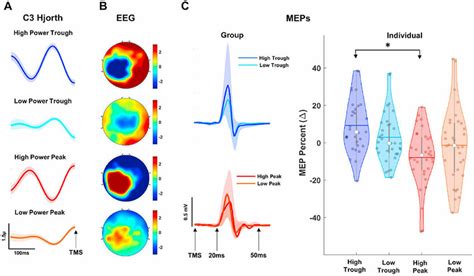 Mep Classification As A Function Of Eeg Phase And Power A Grand