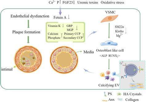 Mechanism Of Vascular Calcification Formation And Related Influencing Download Scientific