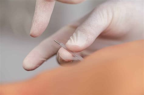 20550 Cpt Code Unlock Your Full Reimbursement Potential