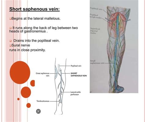 Venous Disorders And Managment 4400 Pptx