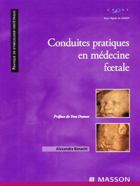 Conduites Pratiques En Médecine Foetale Alexandra Benachi Pdf