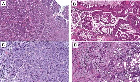 Ref [38] A Number Of Different Patterns Of Growth Can Be Seen A A Download Scientific