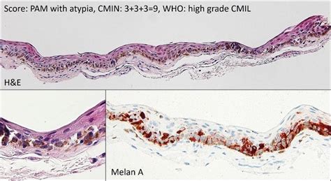 Ma Thesis Development Of A Machine Learning Algorithm For