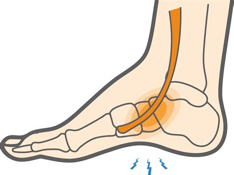 Tendons In The Foot