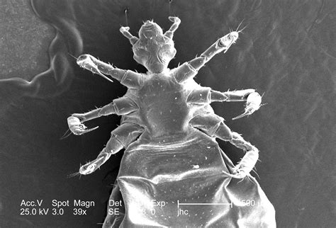 Free Picture Pediculus Humanus Corporis Ventral Perspective