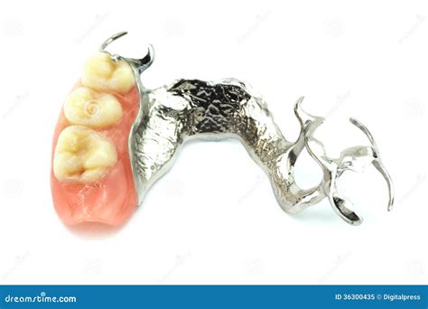 Removable Partial Denture Stock Image Image Of Isolated 36300435