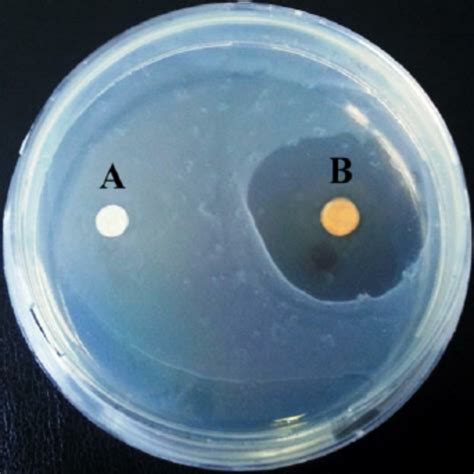 Bacterial Disc Diffusion Assay Liquid Green Tea Seed Against