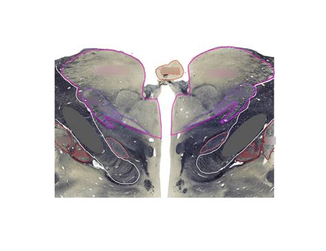 Forebrain Diencephalon 2 Identification Diagram Quizlet