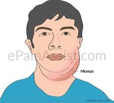 Mumps