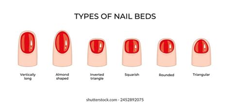 Types Nail Beds 04 Stock Vector Royalty Free 2452892075 Shutterstock