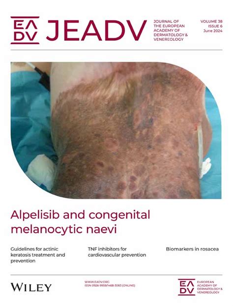 Acroangiodermatitis With Atypical Presentation Diagnostic Imaging With