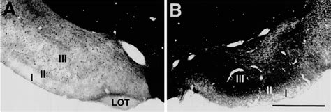 Acetylcholinesterase Ache Staining In Piriform Cortex A Ache