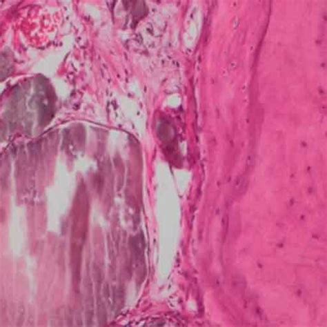 A Defect Group Increased Inflammation Within The Defect Area Download Scientific Diagram