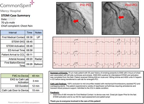 Reducing Stemi Treatment Delays A Quality Improvement Project At A
